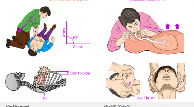 BLS Algorithms 2019 (Basic Life Support)