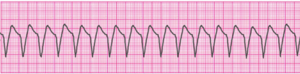 ACLS Algorithms 2023 (Advanced Cardiac Life Support)