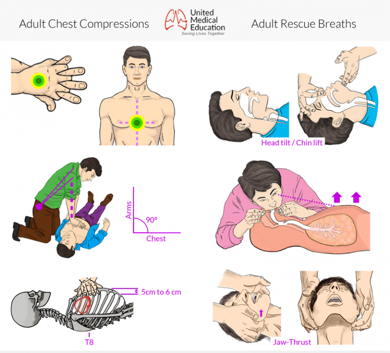 BLS Certification and Renewal - 100% Online
